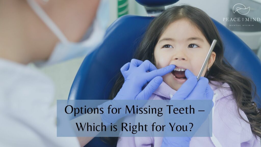 Options for Missing Teeth – Which is Right for You?