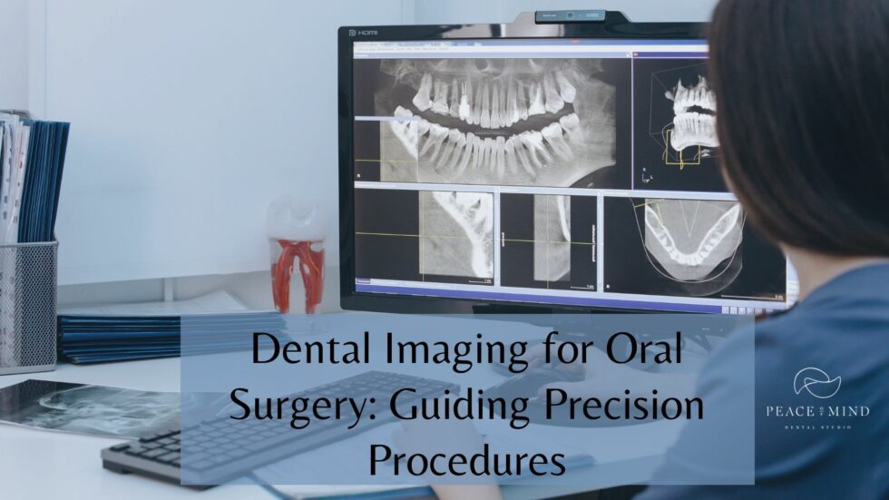 Dental Imaging for Oral Surgery: Guiding Precision Procedures