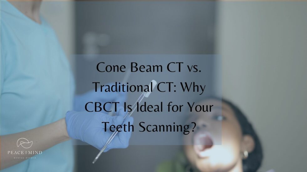 Cone Beam CT vs. Traditional CT: Why CBCT Is Ideal for Your Teeth Scanning?