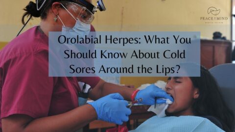 Orolabial Herpes: What You Should Know About Cold Sores Around the Lips?