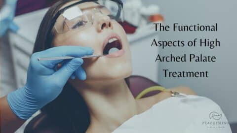 The Functional Aspects of High Arched Palate Treatment