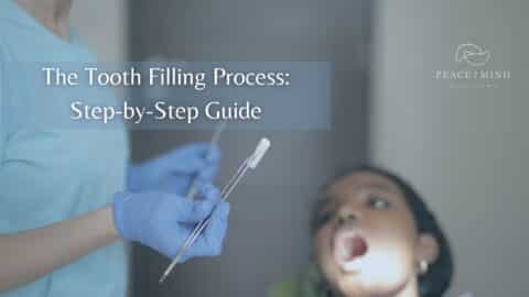 The Tooth Filling Process: Step-by-Step Guide