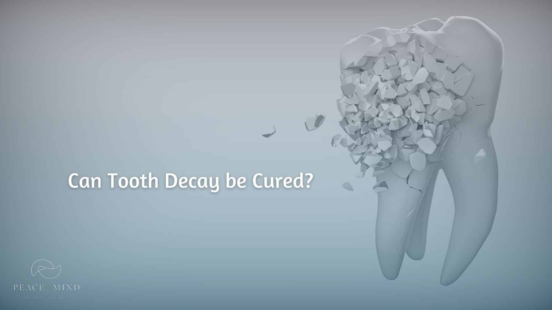 Can Tooth Decay be Cured?