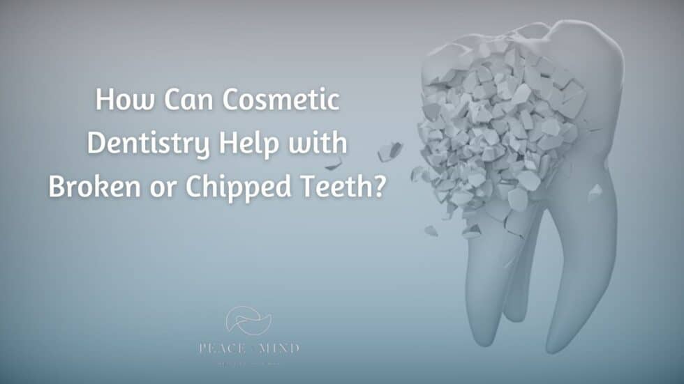 How Can Cosmetic Dentistry Help with Broken or Chipped Teeth?