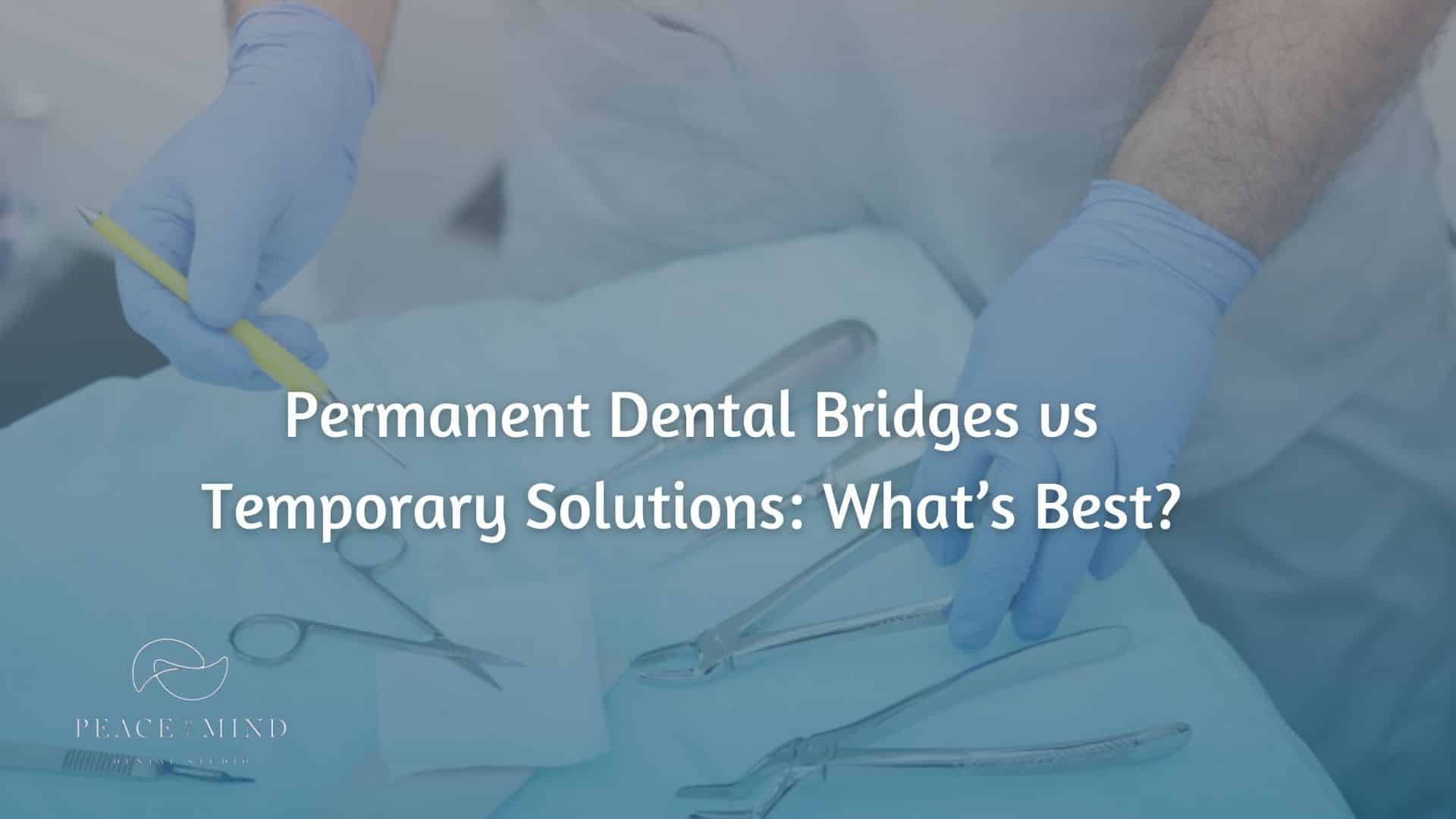 Permanent Dental Bridges vs Temporary Solutions