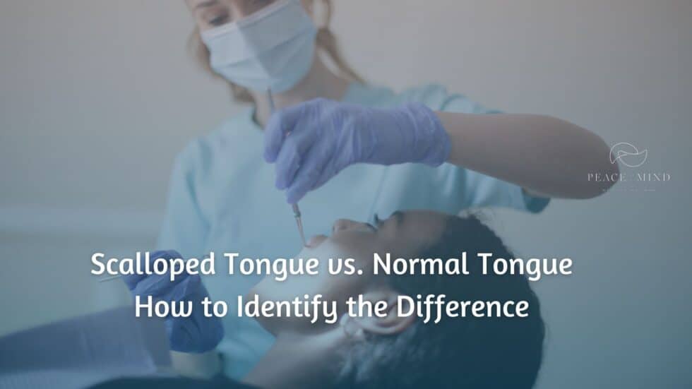 Scalloped Tongue vs. Normal Tongue! Identify the Difference