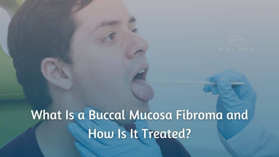 What Is a Buccal Mucosa Fibroma and How Is It Treated?