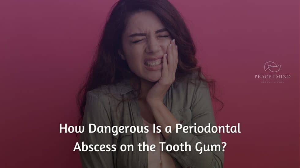 How Dangerous Is a Periodontal Abscess on the Tooth Gum?