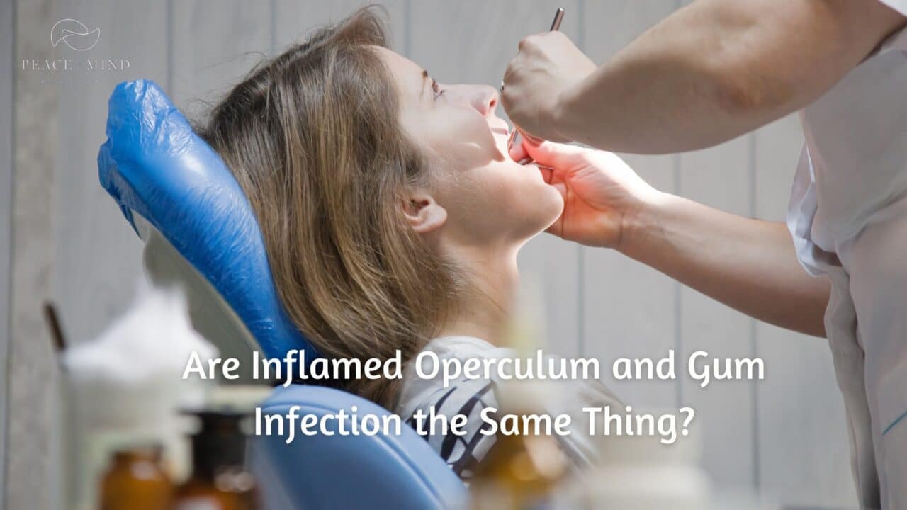 Are Inflamed Operculum and Gum Infection the Same Thing?