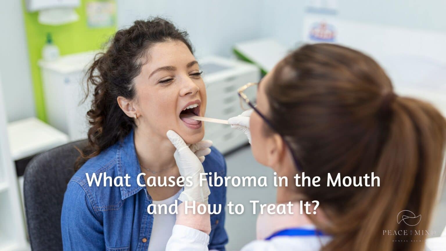 What Causes Fibroma in the Mouth and How to Treat It?